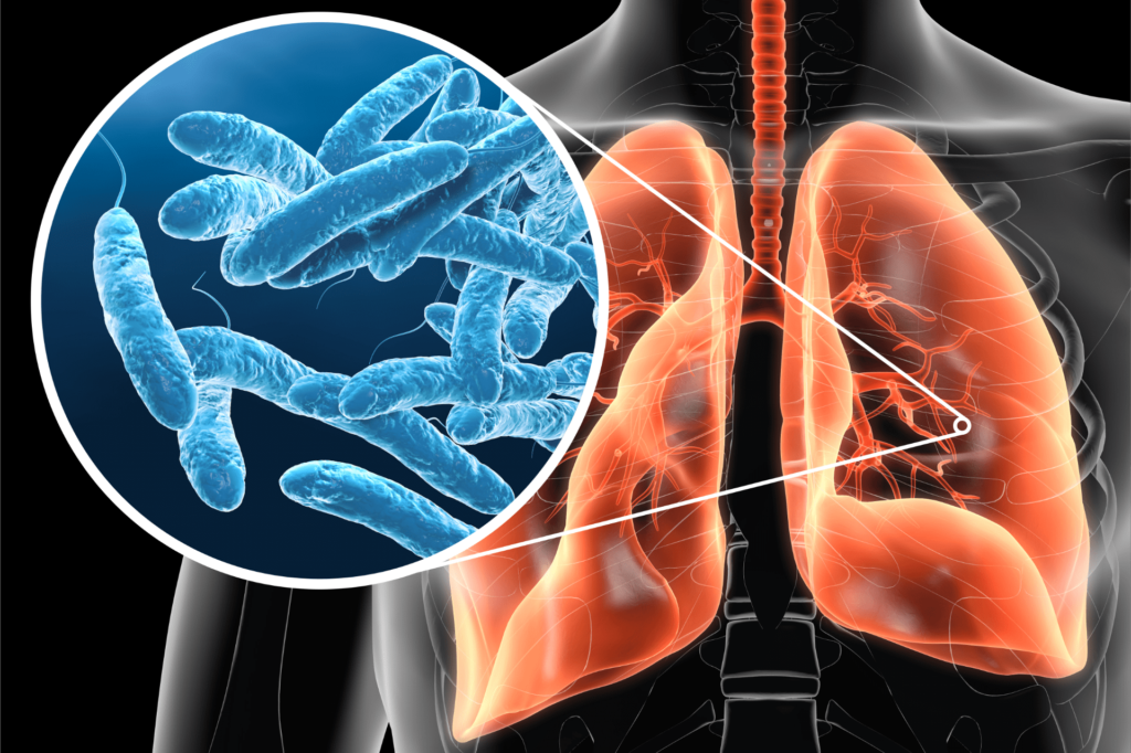 Understanding Legionella: What You Need to Know - Apex Environmental